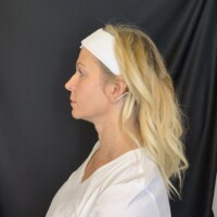 Silent Lift by Dr. Scott Gerrish | Non-Invasive Cosmetic & Regenerative ...