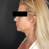 The Silent Lift | Non-Invasive Cosmetic & Regenerative Medicine Experts