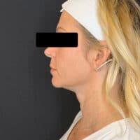 The Silent Lift | Non-Invasive Cosmetic & Regenerative Medicine Experts