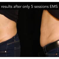 BlissMAX | Non-Invasive Cosmetic & Regenerative Medicine Experts